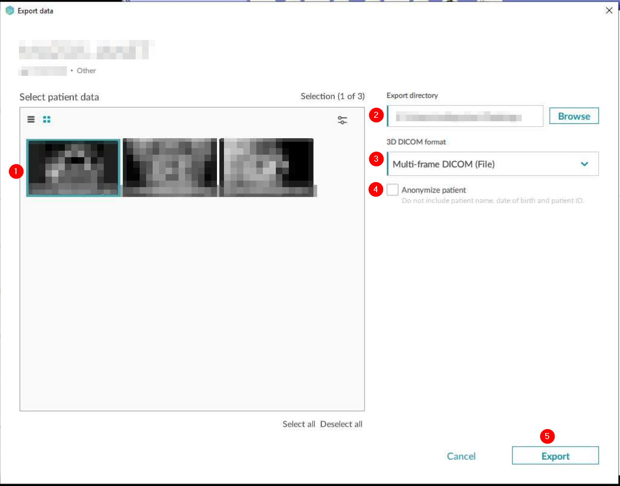 DTX Studio: Import a 3D Scan into XV Capture (Denticon) – Interdent IT