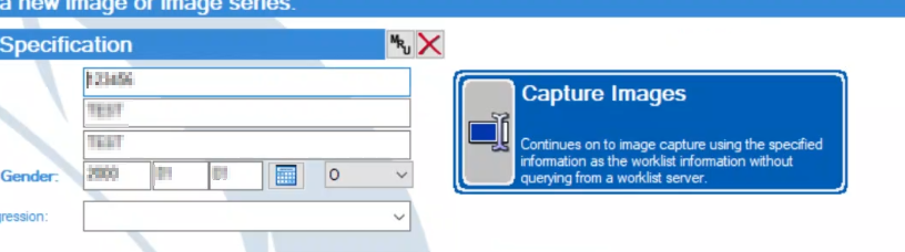XV Capture: Switching between Gendex and IXS Sensors. – Interdent IT