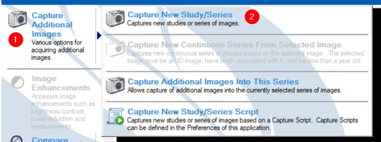 XV Capture: Switching between Gendex and IXS Sensors. – Interdent IT